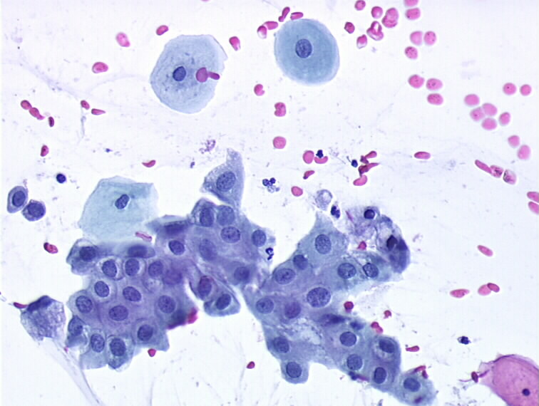 Klamidya Nedir? - libidom.org